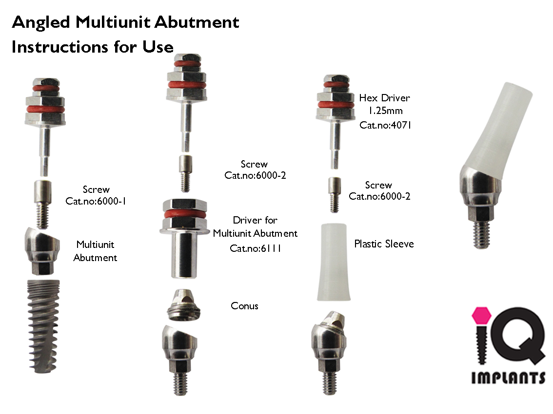 IQ Implants - Multiunit Abutments